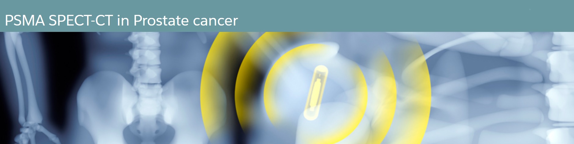 BIR Webinars and Video Courses: State-of-the-art nuclear medicine, PSMA ...